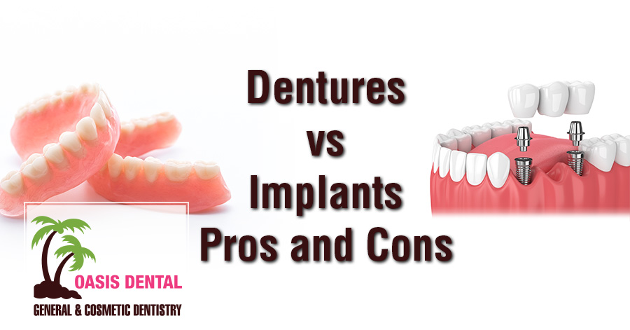 Dentures vs Implants Pros and Cons - Oasis Dental Blog - Oasis Dental